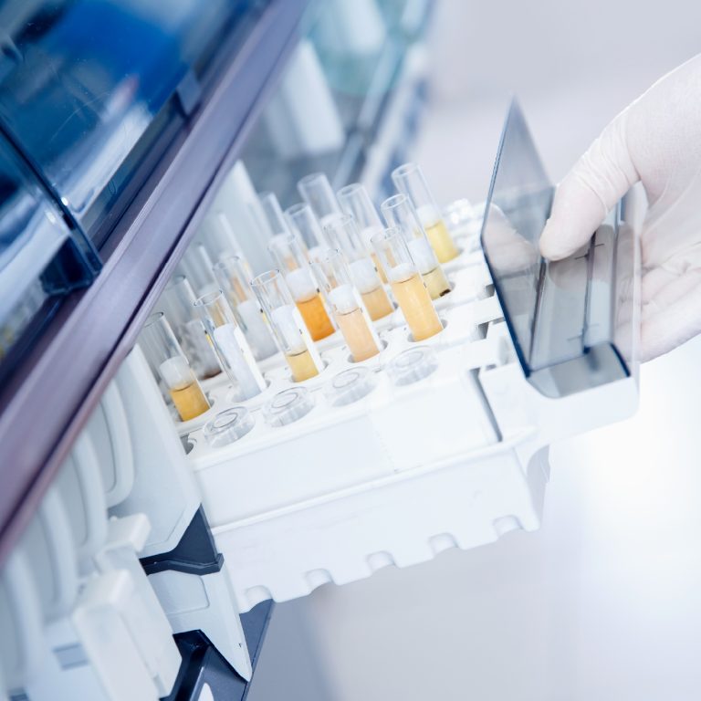 Anticuerpos anti-ribonucleoproteína (ANTI-RNP) | Christus Muguerza