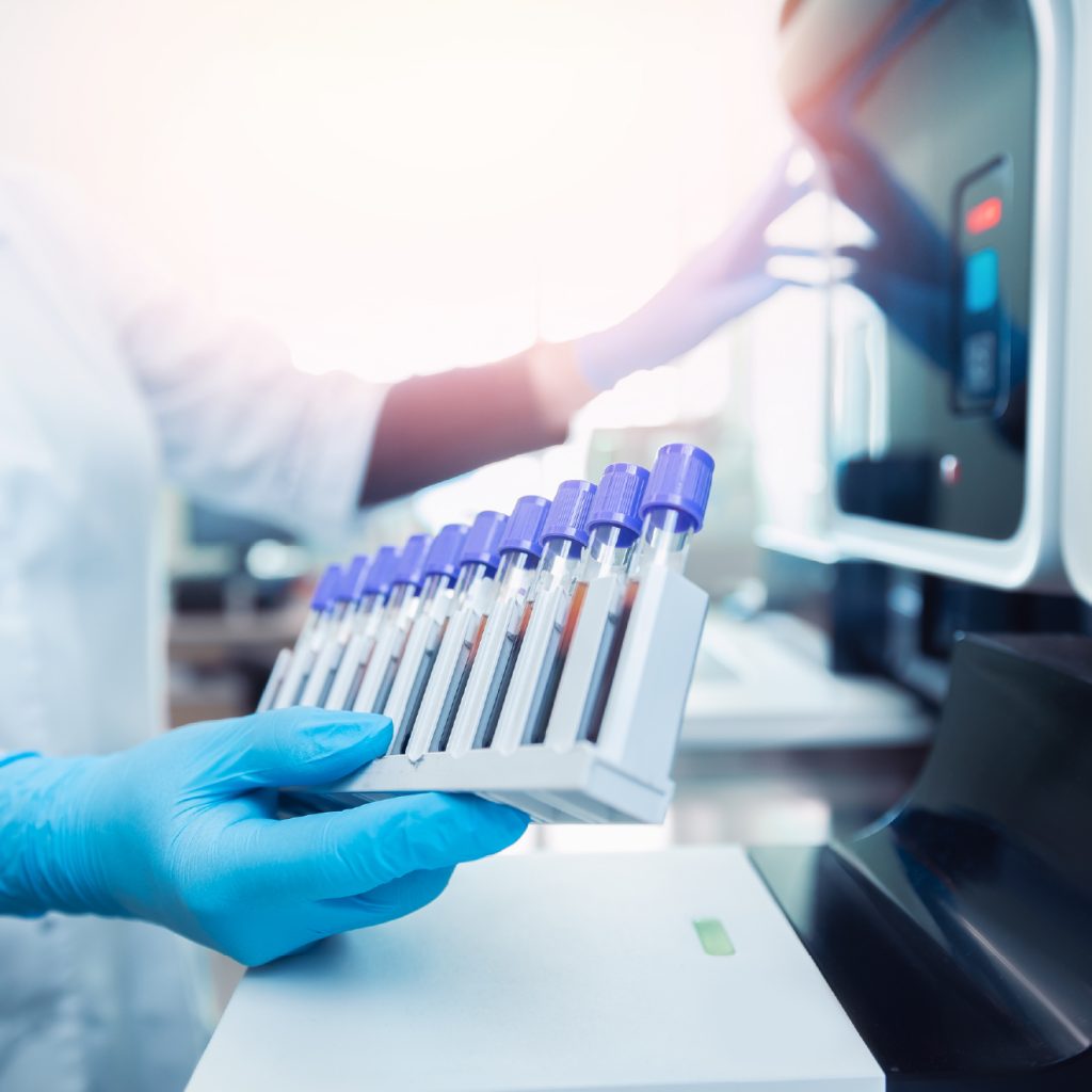 Anticuerpos anti-ribonucleoproteína (ANTI-RNP) | CHRISTUS MUGUERZA ...