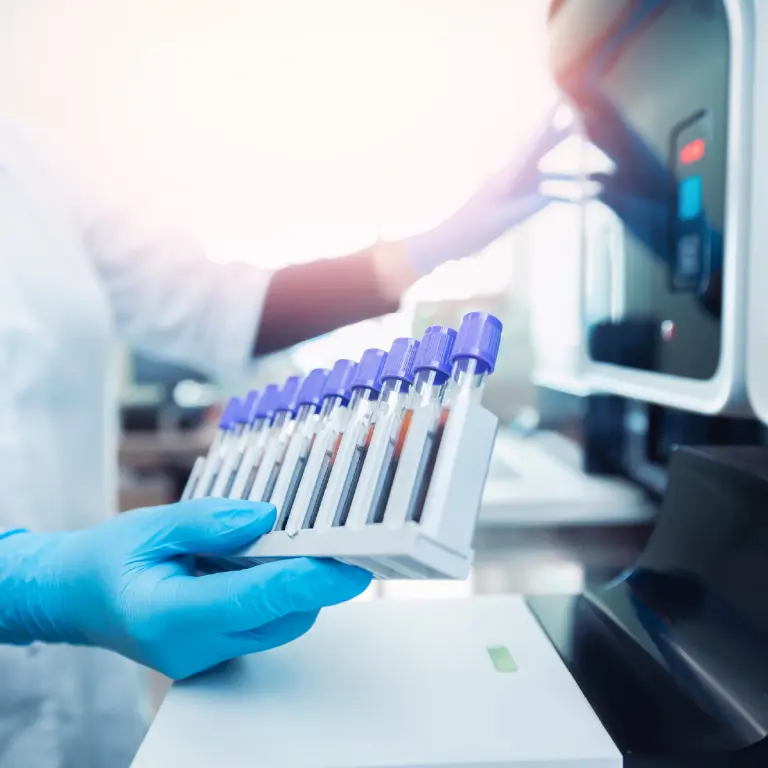 Anticuerpos anti-ribonucleoproteína (ANTI-RNP) | CHRISTUS MUGUERZA ...