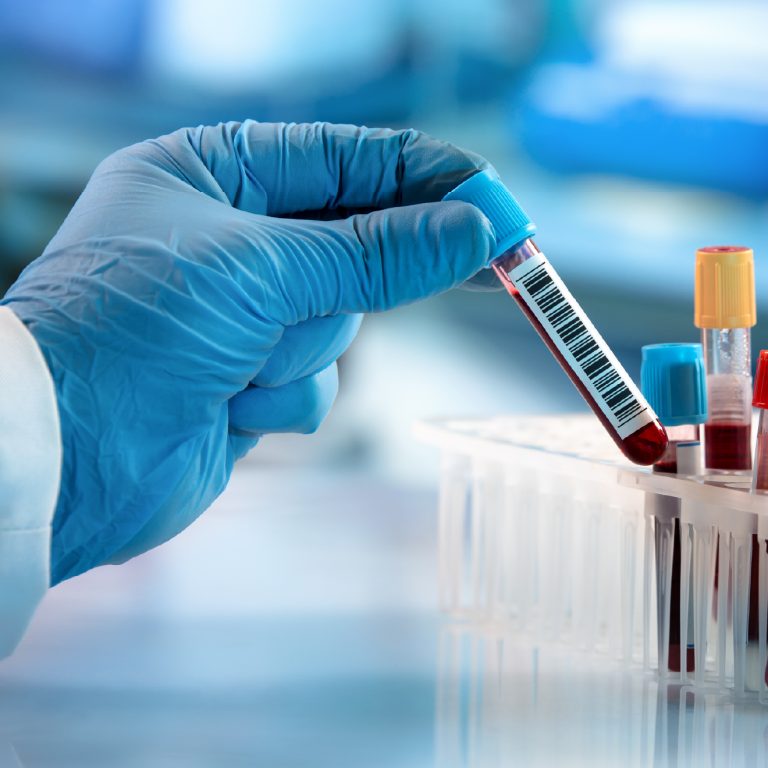 Anticuerpos anti-ribonucleoproteína (ANTI-RNP) - Tienda Christus Muguerza