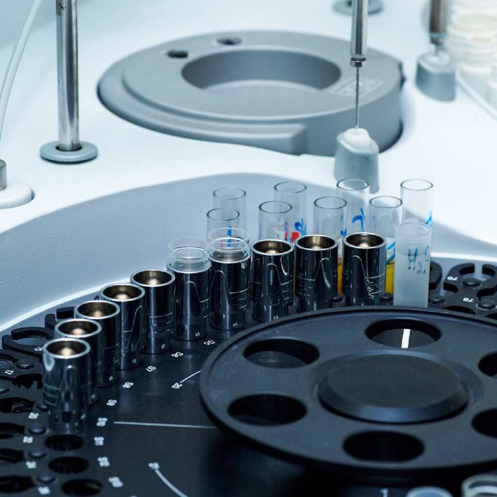 Anticuerpos anti-ribonucleoproteína (ANTI-RNP) | CHRISTUS MUGUERZA ...