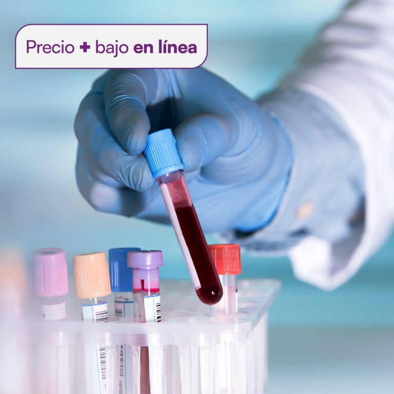 Anticuerpos anti-ribonucleoproteína (ANTI-RNP) | Christus Muguerza