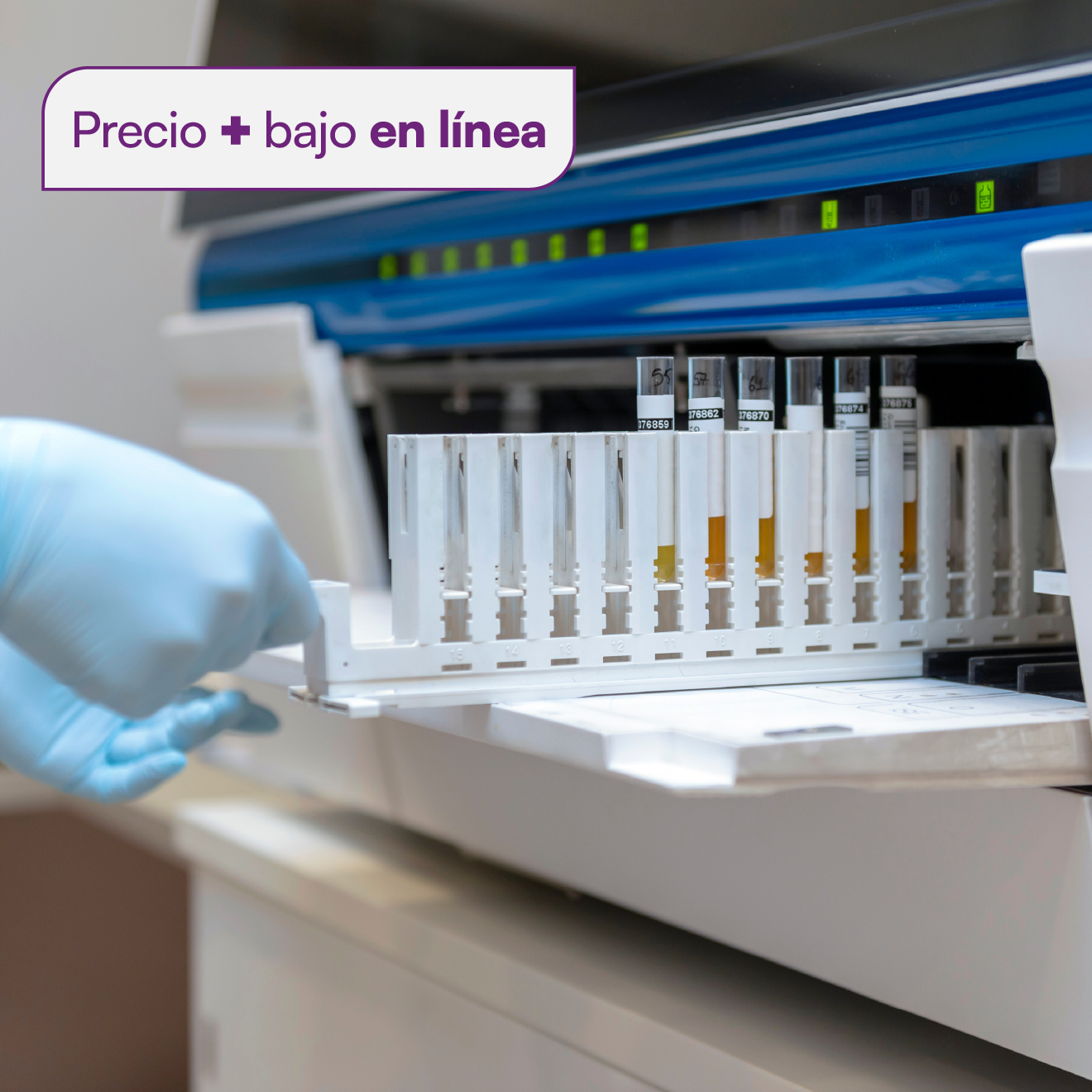 Prueba de embarazo en orina (Cualitativa) | Hospital Sur